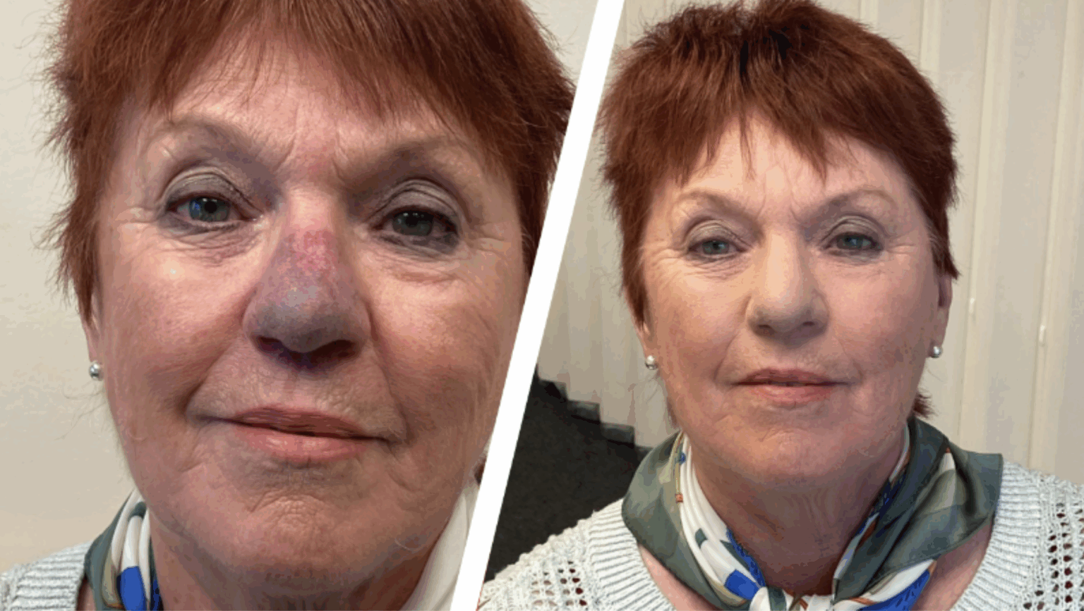 Skin Camouflage - Irish Red Cross